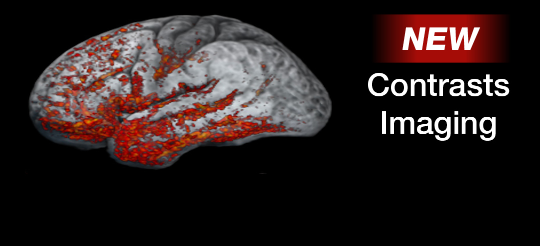 UCSF Radiology | UCSF Department of Radiology & Biomedical Imaging